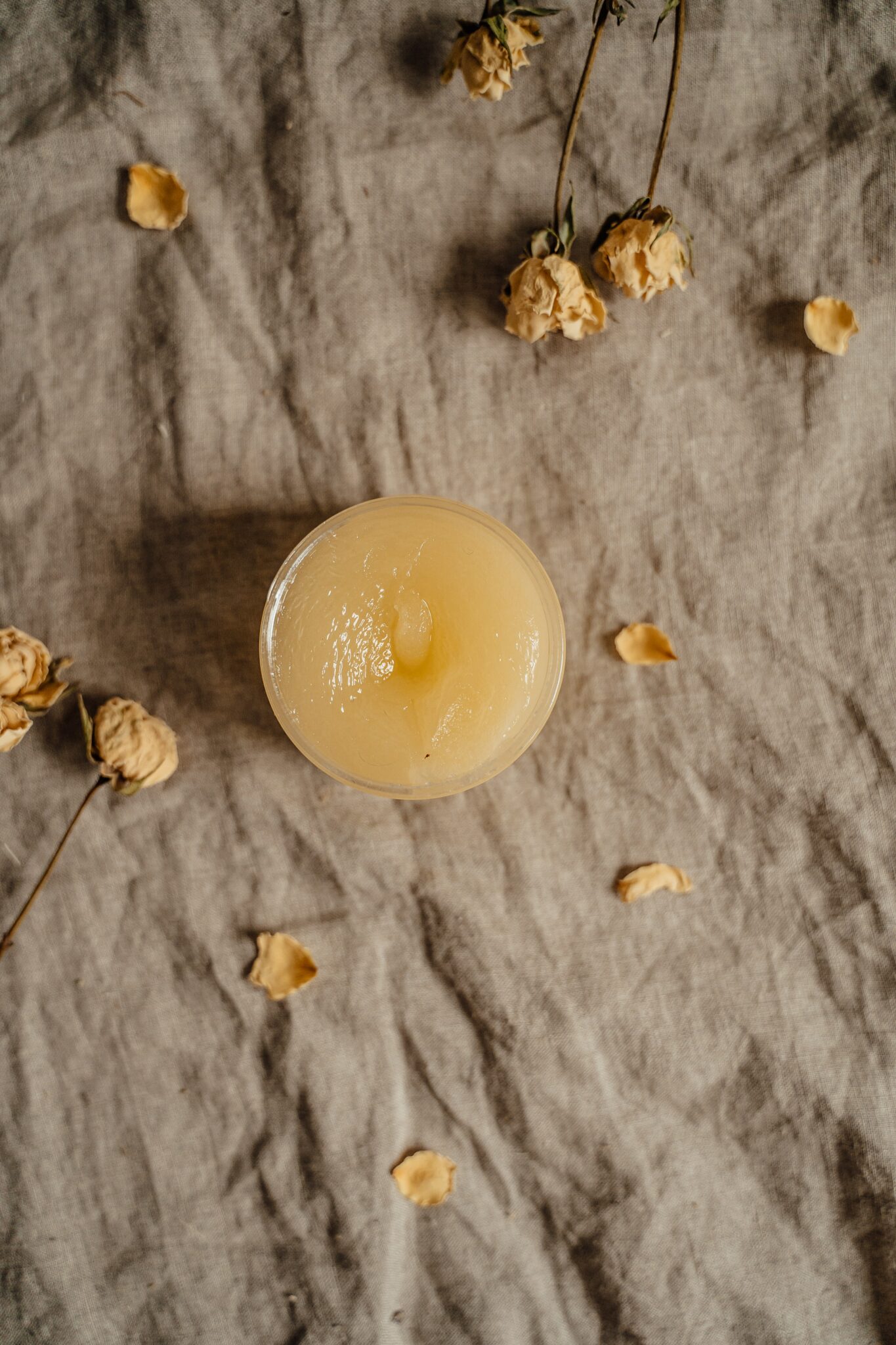 Fimóza: Pravá a nepravá – jaká je léčba? - Urologické listy